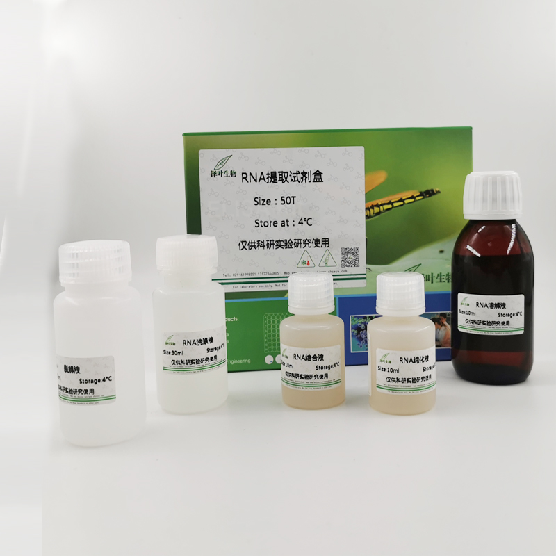 mRNA 纯化试剂盒(Oligo-dT纤维素法) ZY6980817-25 - 泽叶生物 - ELISA试剂盒,试剂盒,检测试剂盒,抗体,抗原,重组蛋白,胎牛血清,ATCC细胞,细胞因子,原代 ...