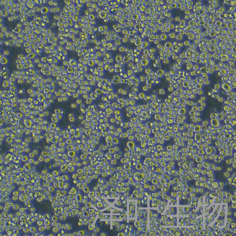 H22-LUC（小鼠肝癌细胞-荧光素酶标记）ZY-C6022M-L - 泽叶生物 - ELISA试剂盒,试剂盒,检测试剂盒,抗体,抗原,重组蛋白,胎牛血清,ATCC细胞,细胞因子,原代细胞 ...