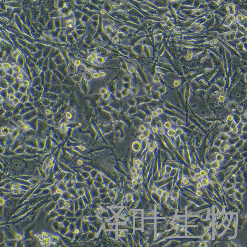 PIG1（正常人皮肤黑色素细胞）ZY-C61108H - 泽叶生物 - ELISA试剂盒,试剂盒,检测试剂盒,抗体,抗原,重组蛋白,胎牛血清 ...